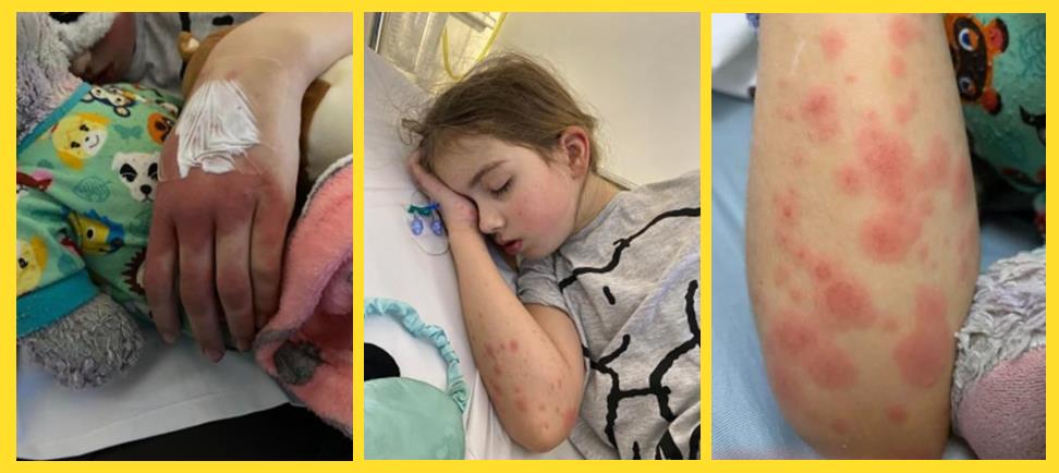 Families' stories of children affected by PIMS